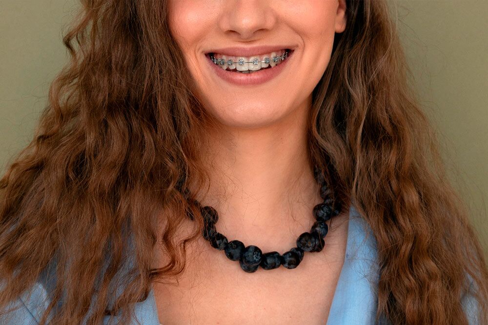 How to Choose the Right Braces - Chroma Dental